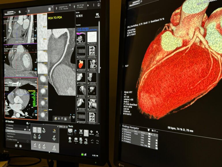 What Cardiac CT Scan Can Detect: Early Diagnosis & Preparation