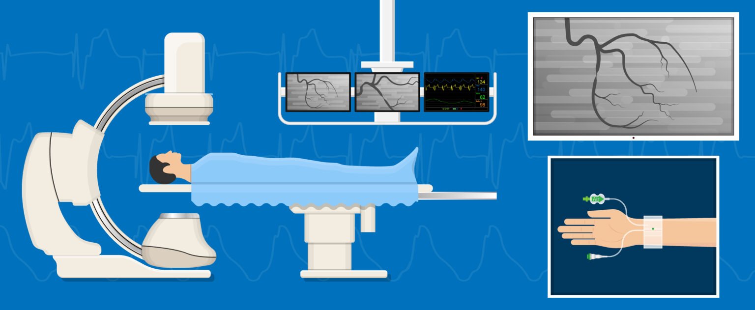 Coronary Angiography: Key to Heart Health