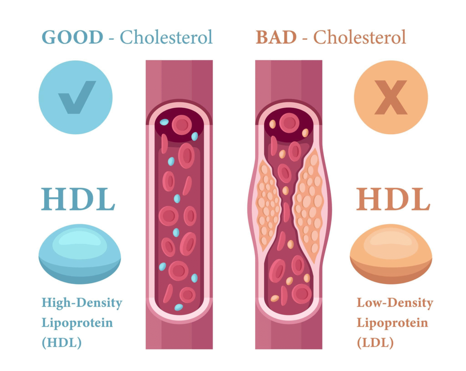 Step-by-Step Guide to Managing High Cholesterol